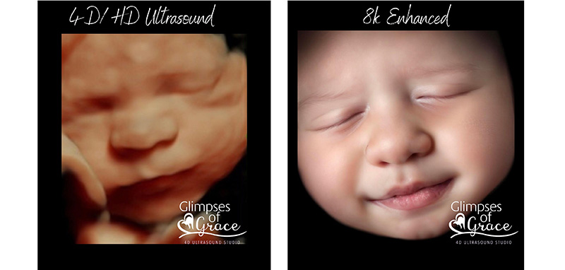 4D/HD/Gender Ultrasound Services in Dothan, Alabama – Glimpses of Grace