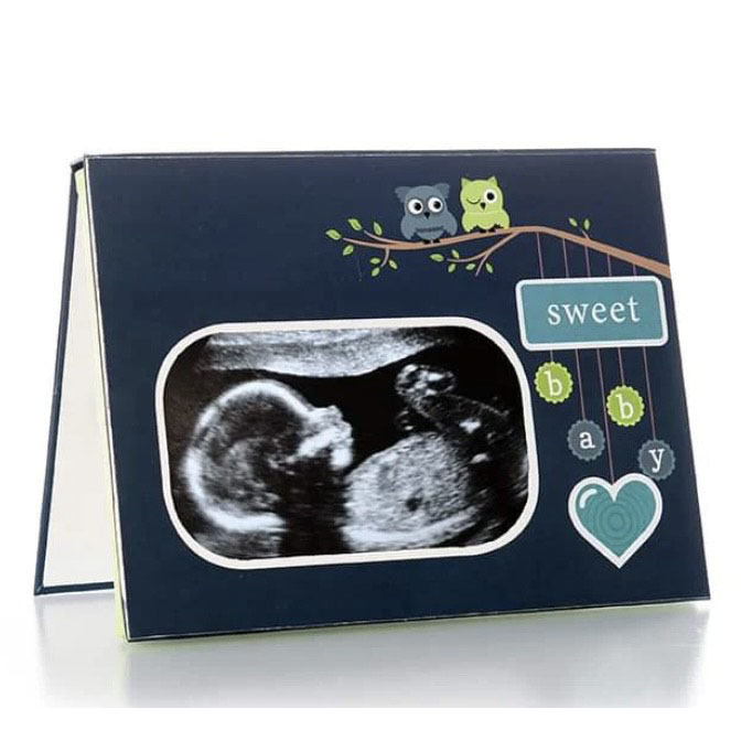 4D/HD/Gender Ultrasound Services in Dothan, Alabama – Glimpses of Grace